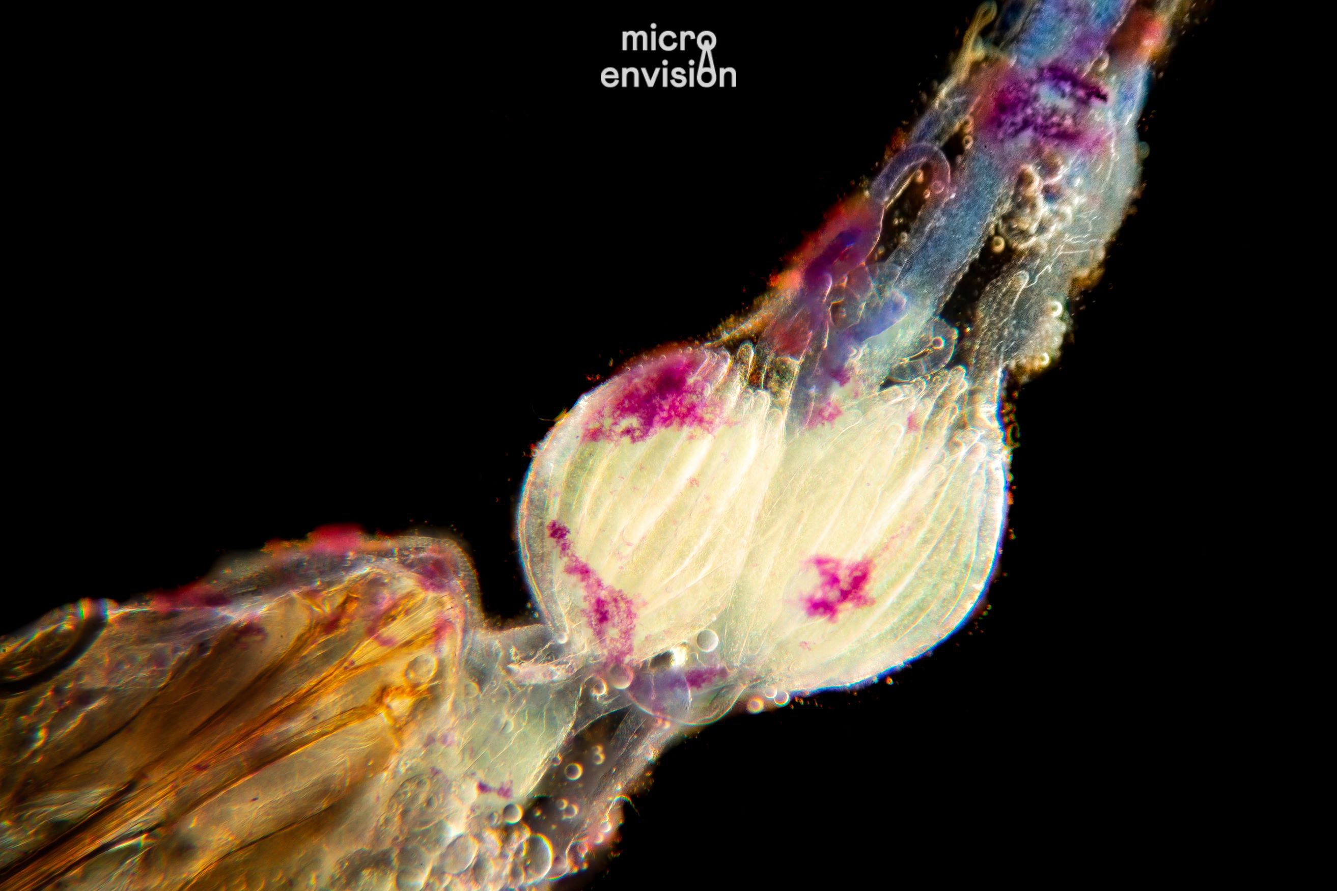 Wolbachia and Its Wasp: A Deep Dive into Parasitic Reproduction ...